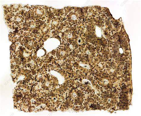 Bone Light Micrograph Stock Image C0264031 Science Photo Library