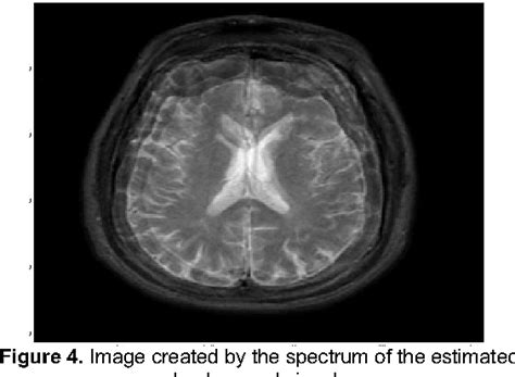 Figure 1 From Lesion Detection Using Morphological Watershed Segmentation And Modelbased Inverse