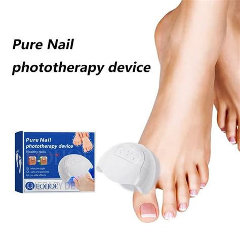Fungal Toenail Laser Treatment