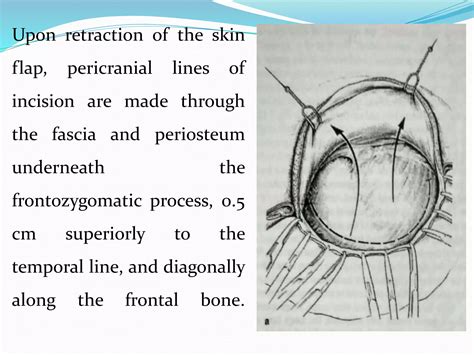 Scalp Incision And Blood Supply PPTX