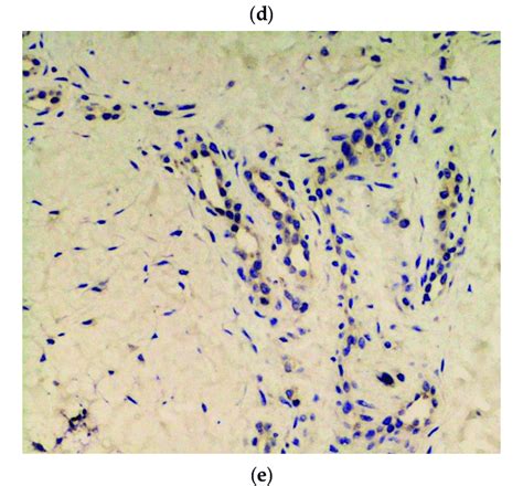 A Example Of A Skin Rash With Polymorphic Erythema Characteristics Download Scientific
