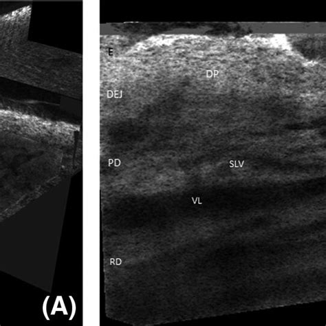Tridimesional Reconstruction Of A Lc‐oct Examination Carried Out In Download Scientific Diagram