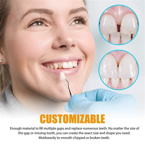 Diy Gap Eliminator Temporary Tooth Substitute Kit With Sculpting Tool