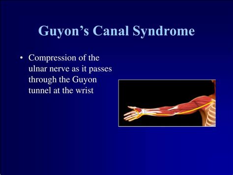 Ppt Ehs 218 Occupational Ergonomics Powerpoint Presentation Free