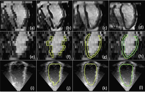 Anatomically Constrained Neural Networks Acnn Application To Cardiac