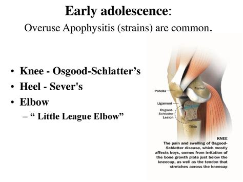 Prevention Of Sports Injuries Specific To The Young Athlete Ppt Download
