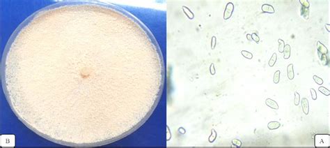 Micro A And Macroscopic B Aspect Of Trichotecium Roseum Download Scientific Diagram