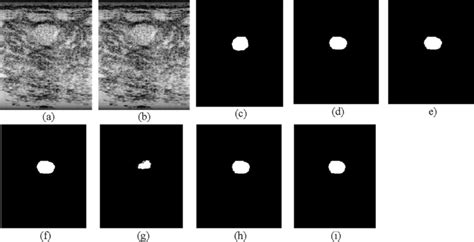A Original Image B Denoised Image C Ground Truth D Predicted Outputs