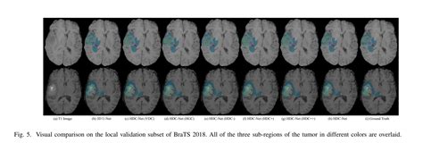 Hdc Net Hierarchical Decoupled Convolution Network For Brain Tumor Segmentation 九叶草的blog