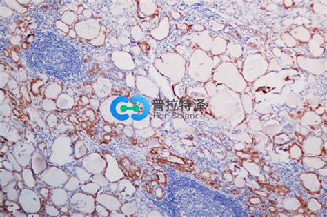 什么是fish技术，fish技术的历史