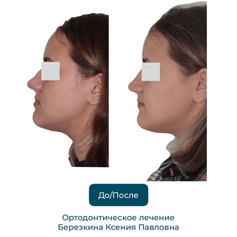 Ортодонтия | СТОМАТОЛОГИЯ В КЕМЕРОВO | ЭСТЕТИКА