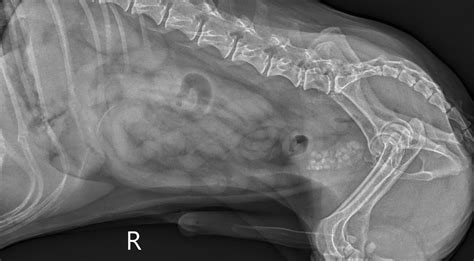 Umn Researchers Discover New Urinary Stoneand A Likely Cause Profiles