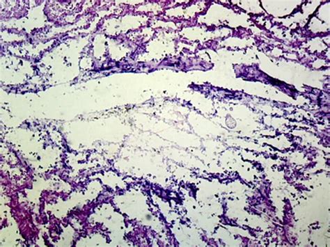 Prepared Microscope Slide Grantia Scypha Longitudinal Section