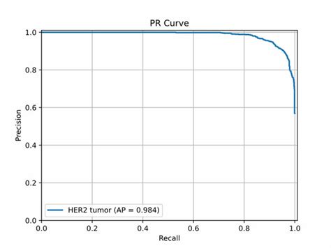 the roc curve and pr curve give an estimation of the cell segmentation