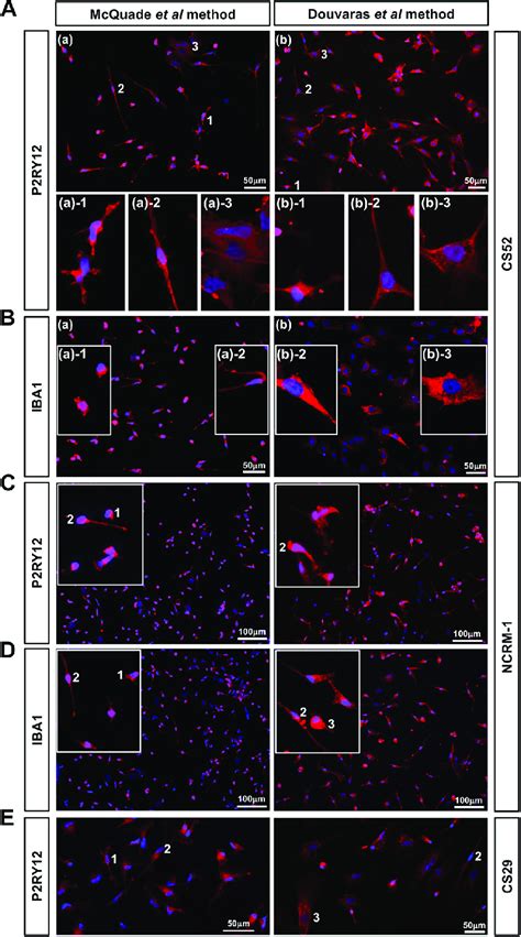 Characterization Of Human Ipsc Derived Microglia By Download Scientific Diagram