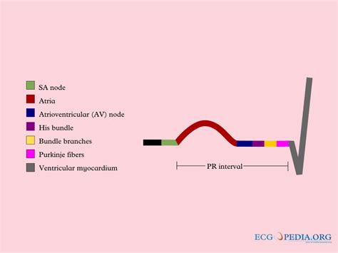File Pr Interval Buildup Svg Ecgpedia