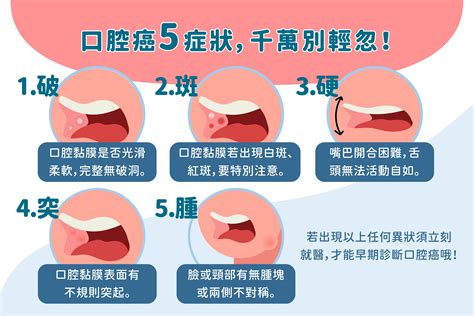 臺北市政府衛生局 口腔癌防治與篩檢