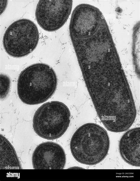 Transmission Electron Micrograph Of Clostridium Botulinum Bacteria The Cause Of Botulism Food