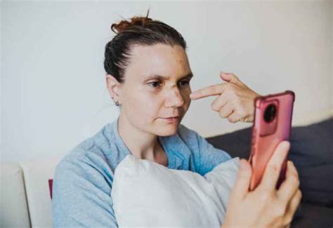 Nose Tip Lift With Botox Diaminyaesthetics