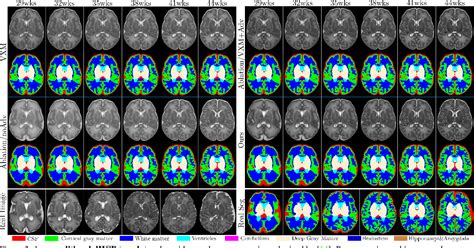 Figure 3 From Generative Adversarial Registration For Improved