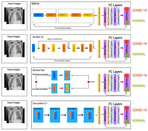 Sensors Free Full Text Detection Of COVID Using Transfer Learning And Grad CAM