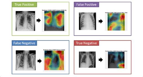 Performance Examples Of Visualization Diagnosis Using Class Download Scientific Diagram