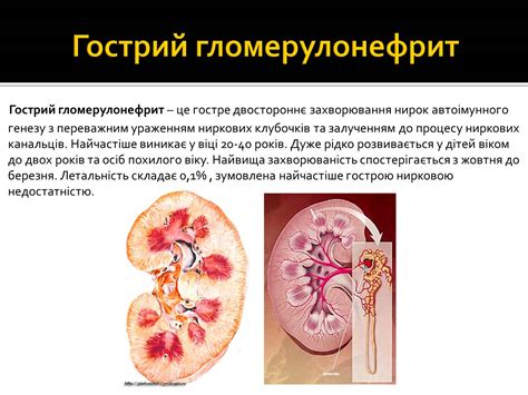 Презентація на тему Захворювання нирок та сечовивідних шляхів — презентації з біології Gdz4you