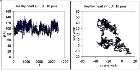 Heartbeat Intervals Rri Of A Healthy Person Left Time Series Download Scientific Diagram