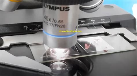 Bacillus And Pseudomonas Motility Demonstration By A Hanging Drop