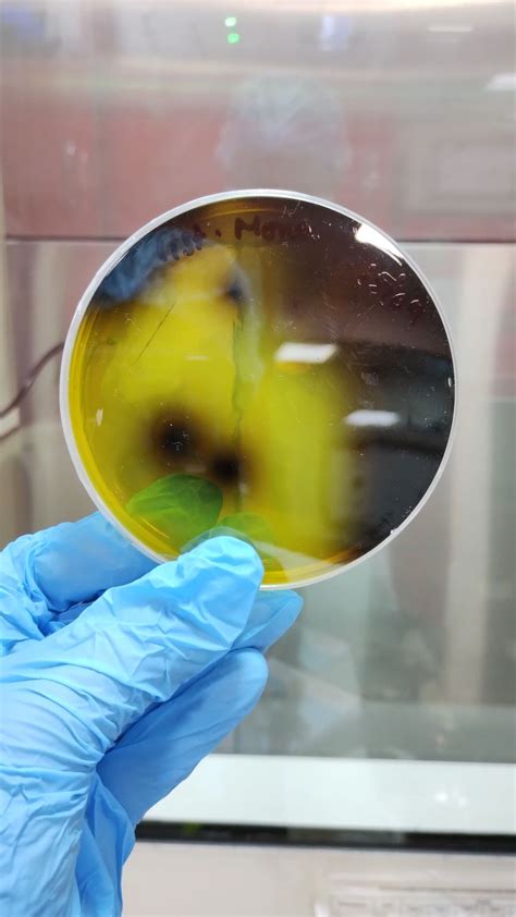 Srushti Pardeshi On Linkedin Listeria Monocytogenes On Oxford Agar And Palcam Agar Is 🫶🔥 Two…