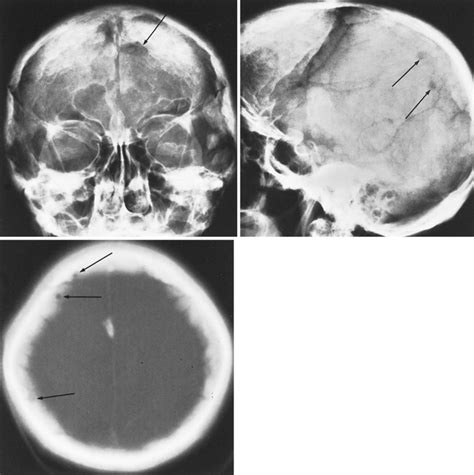 The Skull Clinical Tree