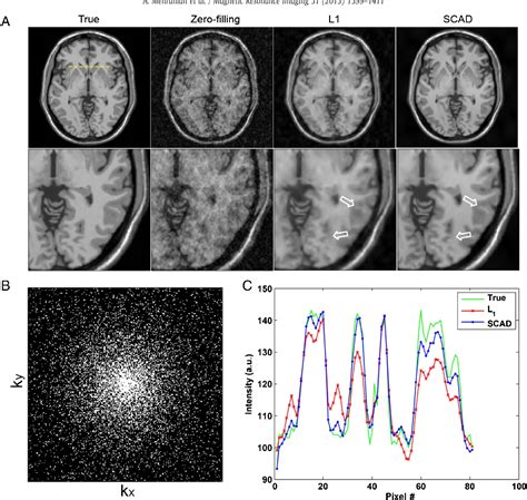 Figure 1 From Smoothly Clipped Absolute Deviation Scad Regularization For Compressed Sensing