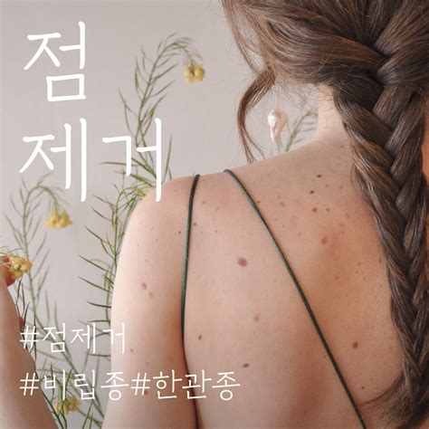 점제거 할인 가격 후기 전후 효과 정보 By 룩엣미의원 여신티켓 국내 1등 피부과 성형외과 플랫폼