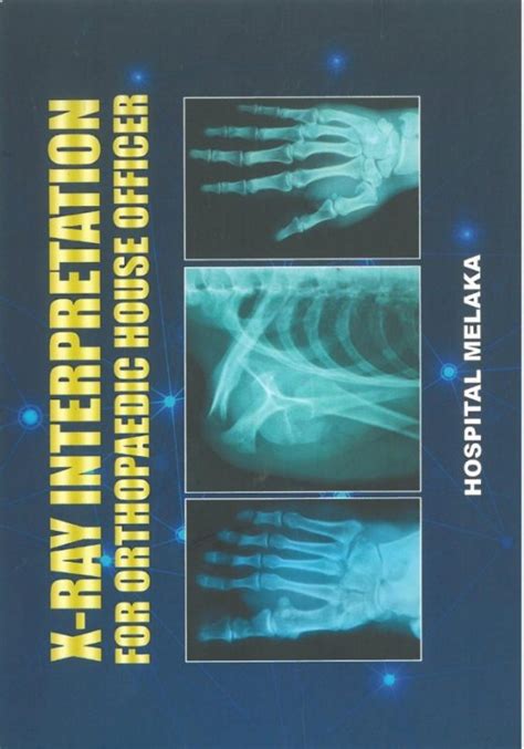 X Ray Interpretation For Orthopaedic House Officer A Z Bookstore