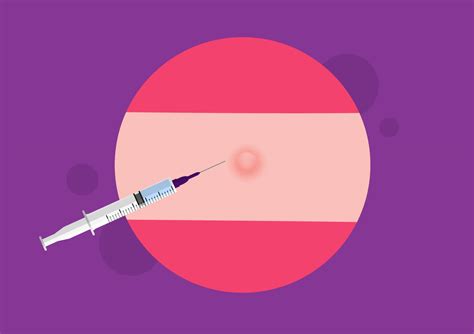 Tes Mantoux Prosedur Persiapan Dan Kapan Lakukan Tes Halodoc