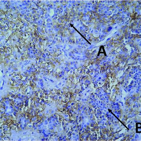 Schematic Of The Hyaluronan Enriched Extracellular Matrix Hyaluronan