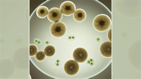 Can Lube Cause A Yeast Infection And Ones That Wont