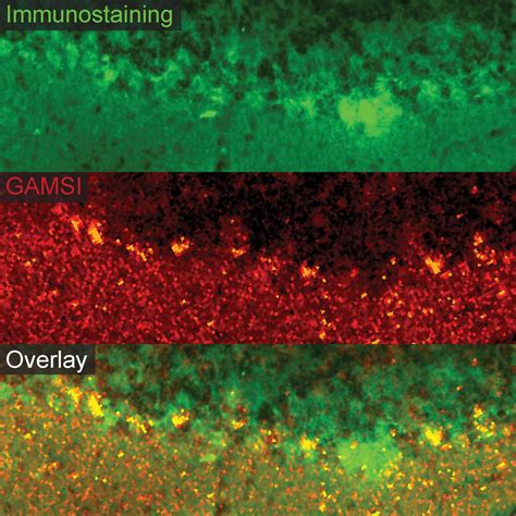 Gel Assisted Mass Spectrometry Imaging Gamsi Protocol