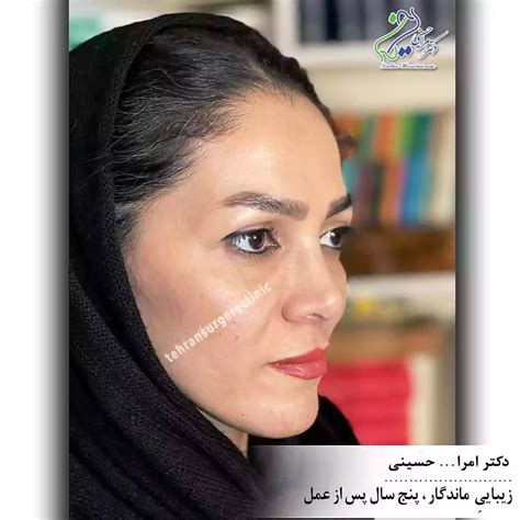 دکتر حسینی امرالله حسینی از بهترین جراحان زیبایی بینی