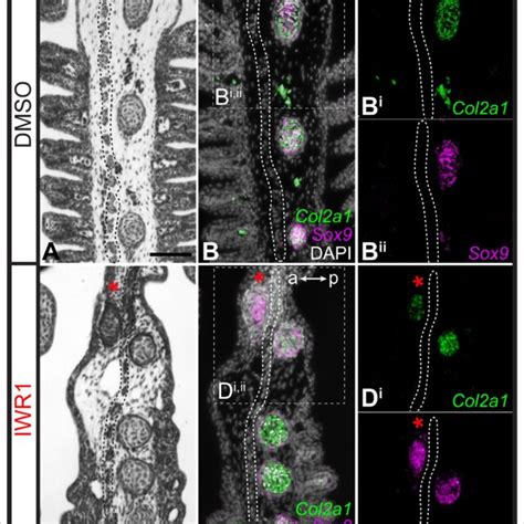 Repression Of Cartilage Development In The Anterior Gill Arch By Wnt Download Scientific