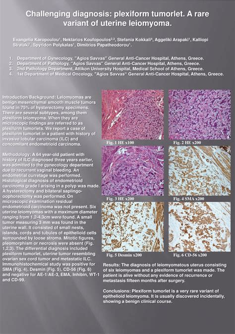 Pdf Ep717 Challenging Diagnosis Plexiform Tumorlet A Rare Variant