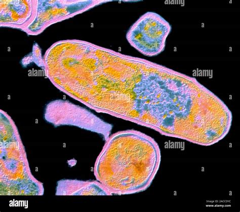 False Colour Transmission Electron Micrograph Tem Of Corynebacterium Diphtheria Showing A
