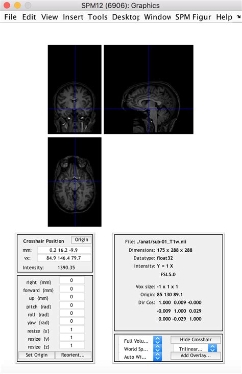 SPM12 Matlab Scripting Tutorial Post 2 SPM12 Matlab Scripting Tutorial Post 2