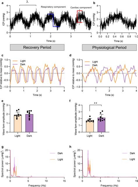 Waveform Analysis Of Icp Measured In Freely Moving Animals A Icp Download Scientific Diagram Waveform Analysis Of Icp Measured In Freely Moving Animals A Icp Download Scientific Diagram
