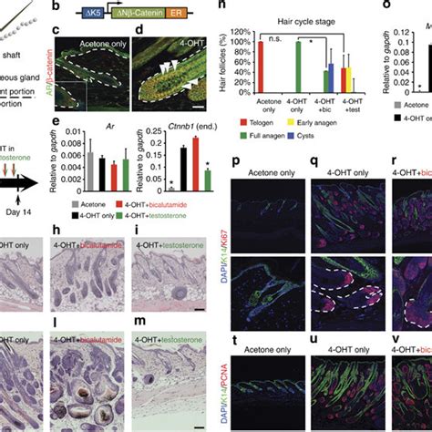 Androgen Receptor Ar Activity Modulates β Catenin Target Gene