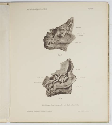 Atlas Der Anatomie Der Stirnhöhle Der Vorderen Siebenzellen Und Des
