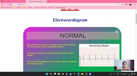 Ecg Arrhythmia Classification Image Based Cnn Classification Project Youtube