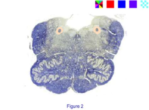 Lecture 61 Chemical Senses Flashcards Quizlet