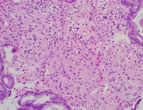 Pathology Now Department Of Pathology University Of Rochester Medical Center