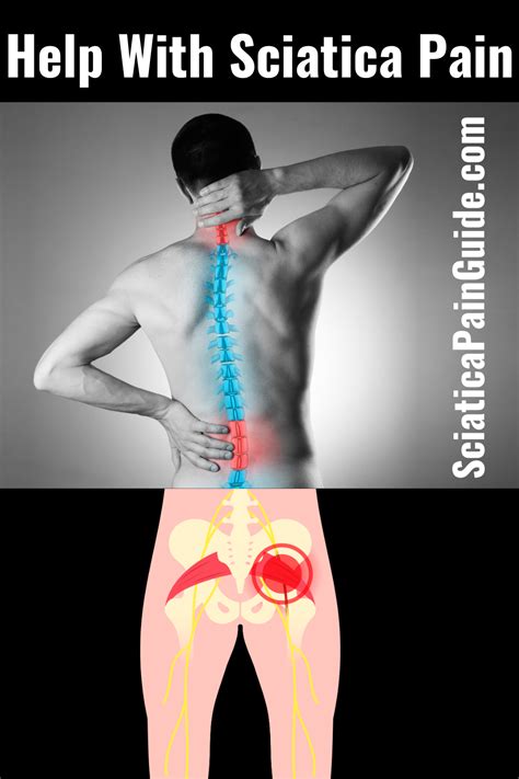 Help With Sciatica Pain Sciatica Pain Guide